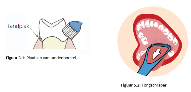 Richtlijnen Langdurige Zorg